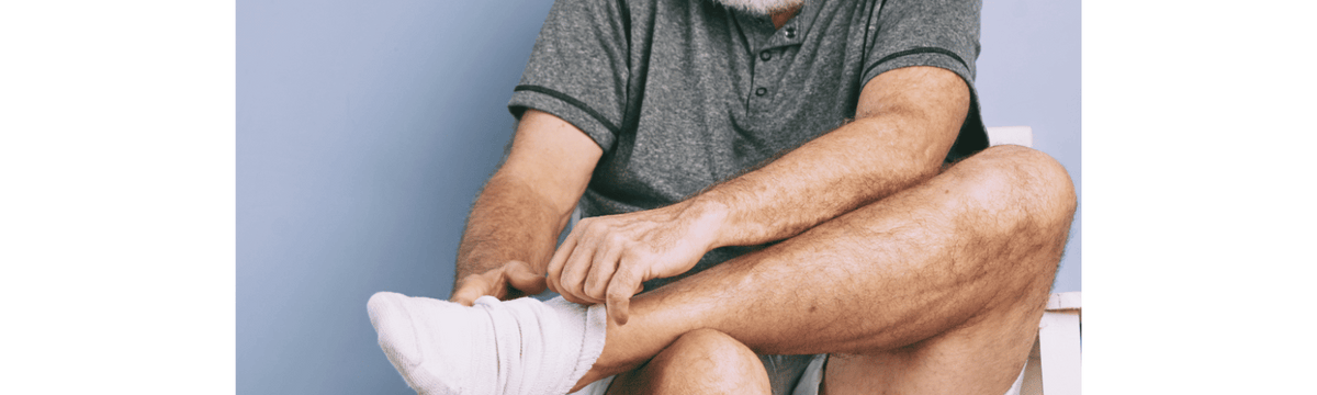 Sock Marks on Your Legs: Normal or a Health Concern? — Monfoot